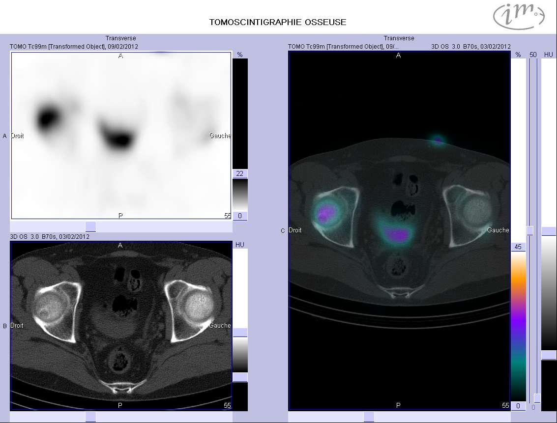 Centre TEP et TEPSCAN de Toulouse Clinique Pasteur