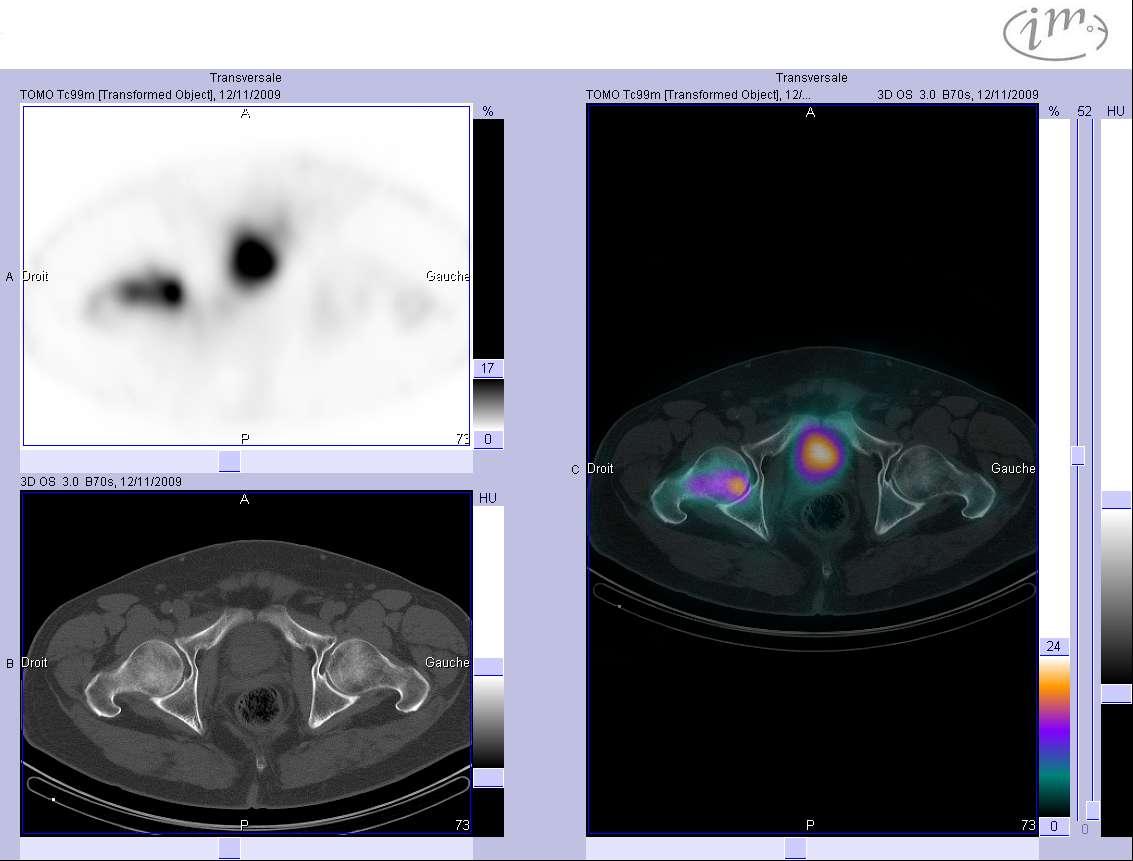 Centre TEP et TEPSCAN de Toulouse Clinique Pasteur